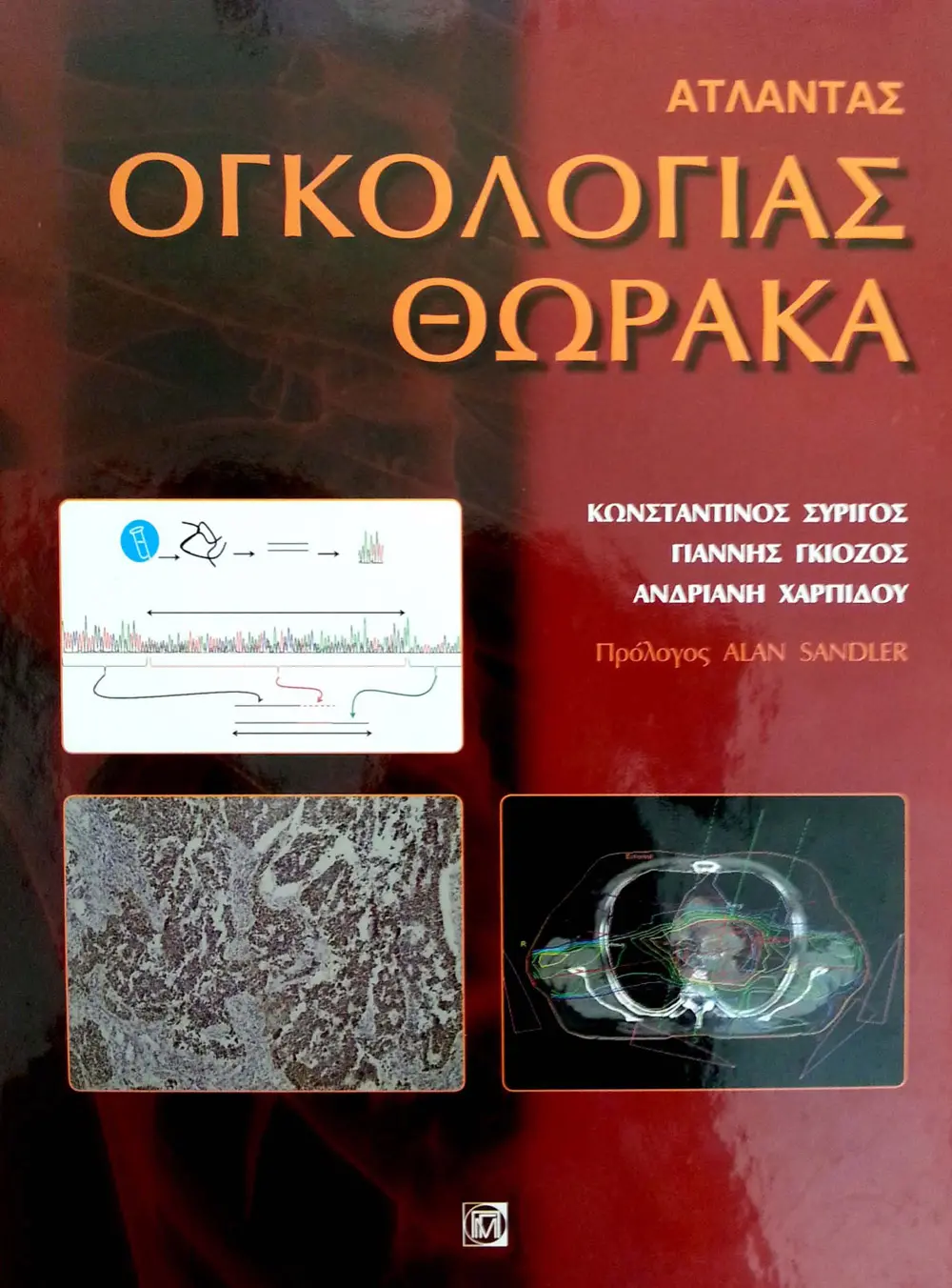 Άτλαντας ογκολογίας θώρακα - Ιωάννης Γκιόζος
